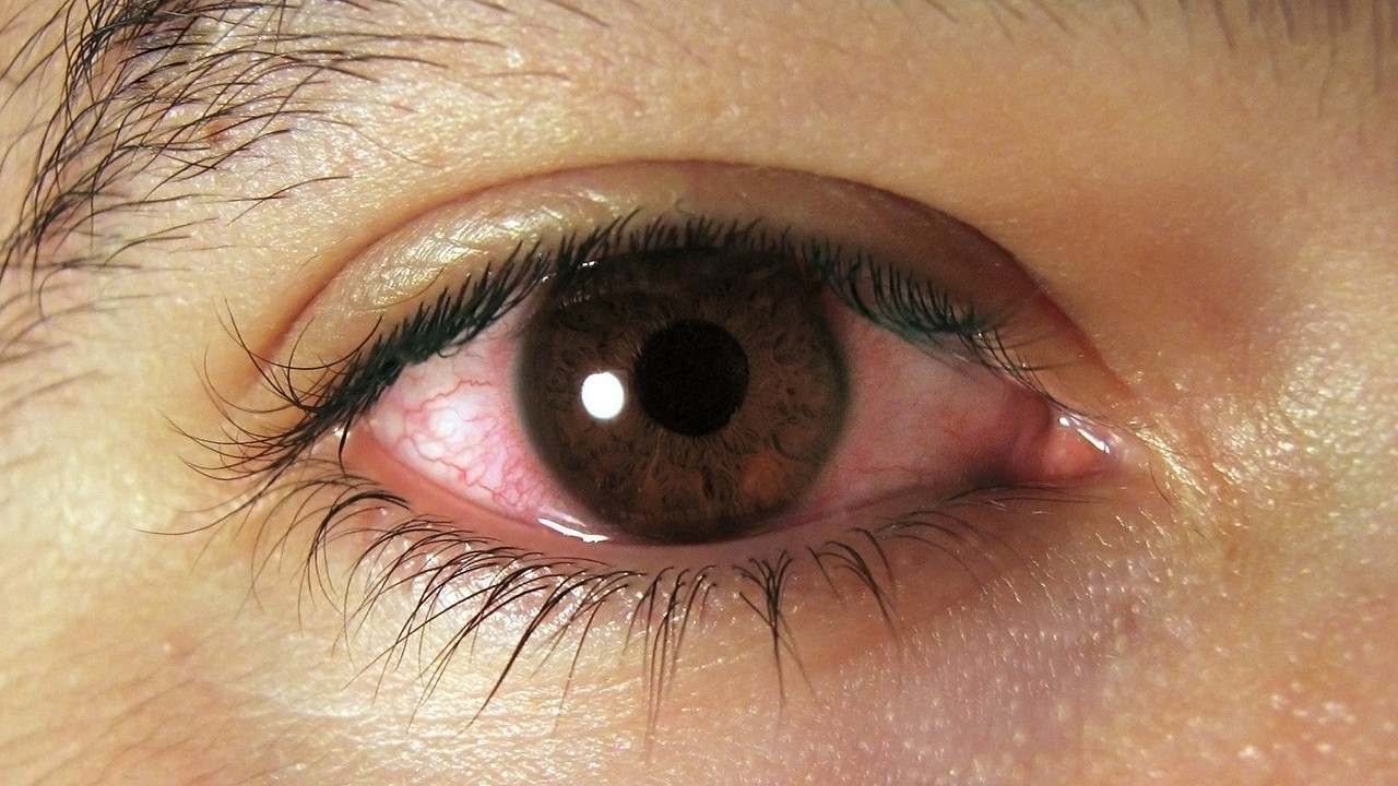 Gotas y colirios para ojos rojos - Olaiz